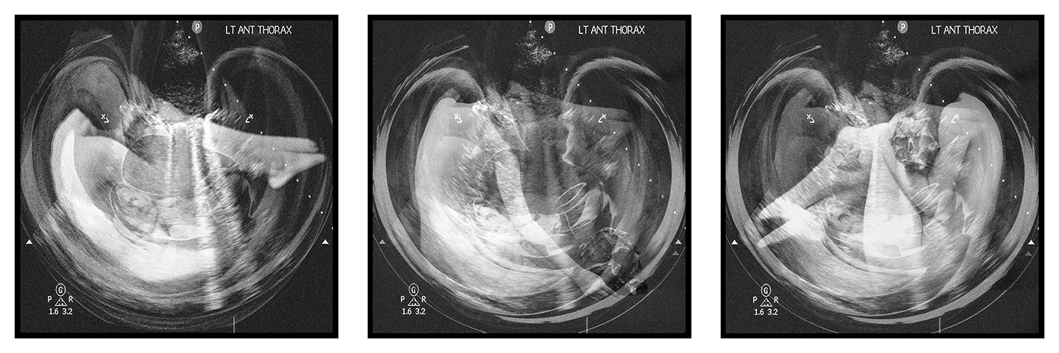 Ecography | Foundation